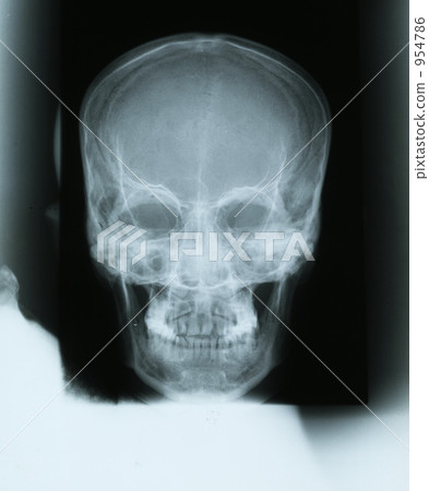 Head X-ray Photo - Stock Photo [954786] - PIXTA