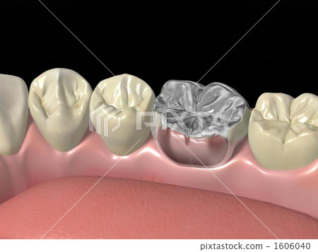 Silver teeth Images - Search Images on Everypixel