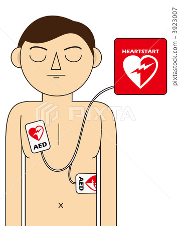 AED cardiopulmonary resuscitation 2 - Stock Illustration [3923007] - PIXTA