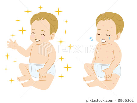 Baby rash - Stock Illustration [8966301] - PIXTA