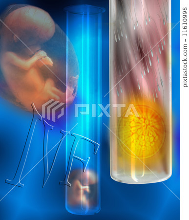 IVF - In vitro fertilisation - Stock Illustration [11610998] - PIXTA