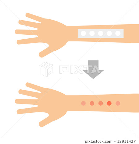 Patch test - Stock Illustration [12911427] - PIXTA