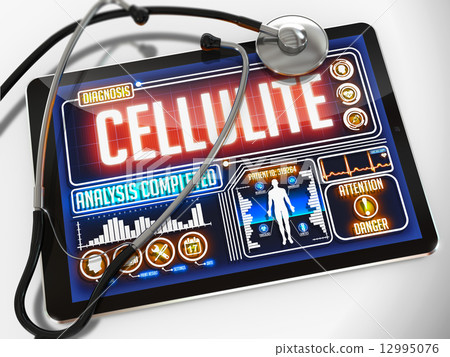 Cellulite on the Display of Medical Tablet. - Stock Illustration ...