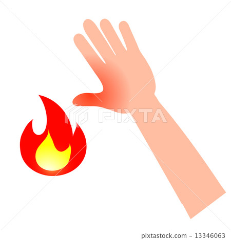 burns, hand, scald - Stock Illustration [13346063] - PIXTA