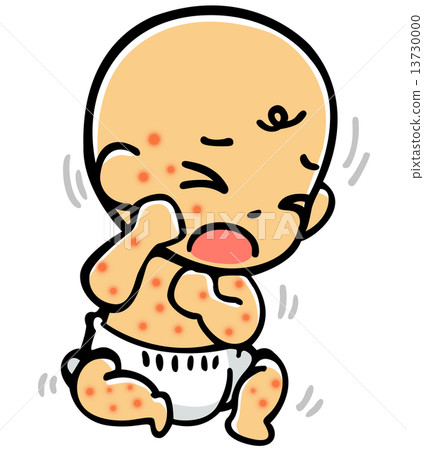 Rash Baby - Stock Illustration [13730000] - PIXTA