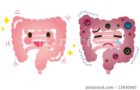 Healthy colon sick colon - Stock Illustration [13930985] - PIXTA