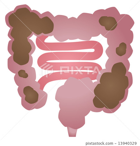 Constipation of large intestine human body - Stock Illustration ...