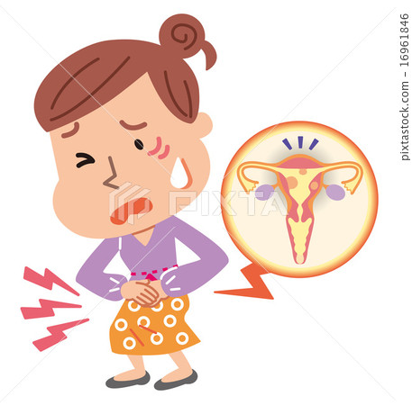 Uterine fibroid female illustration - Stock Illustration [16961846] - PIXTA