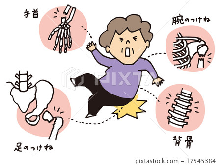 跌倒的老人（有骨折圖）-插圖素材 [17545384] - PIXTA圖庫