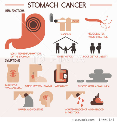 Stomach cancer vector - Stock Illustration [18660121] - PIXTA