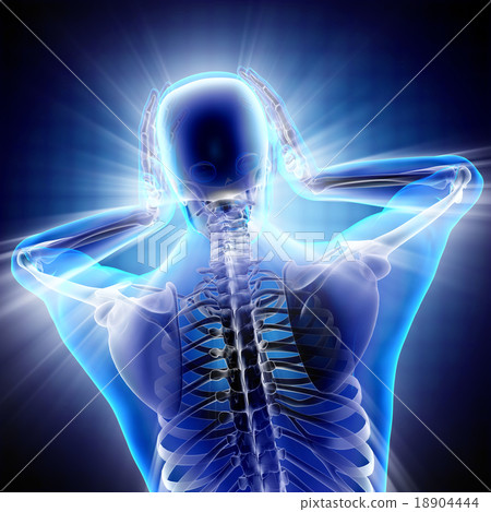 human with headache radiography scan - Stock Illustration [18904444 ...