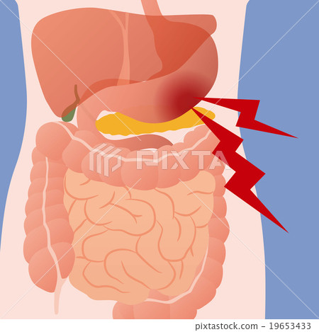 Human Digestive System And Stomach Pain Stock Illustration human-digestive-system-and-stomach-pain-stock-illustration