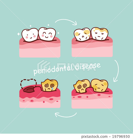 cartoon tooth periodontal disease - Stock Illustration [19796930] - PIXTA
