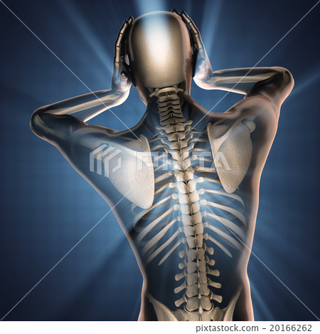human with headache radiography scan - Stock Illustration [20166262 ...