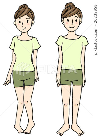 Pelvic distortion comparison illustration - Stock Illustration ...