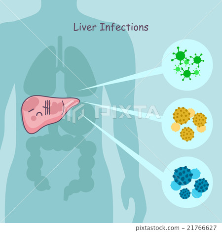 cute cartoon liver infections - Stock Illustration [21766627] - PIXTA