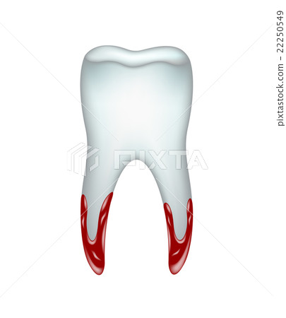Pulled tooth with blood on white background - Stock Illustration ...