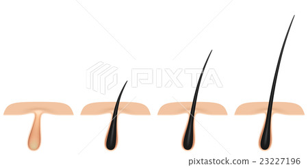 Hair root section - Stock Illustration [23227196] - PIXTA
