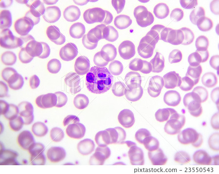 White blood cell in peripheral blood smear - Stock Photo [23550543] - PIXTA