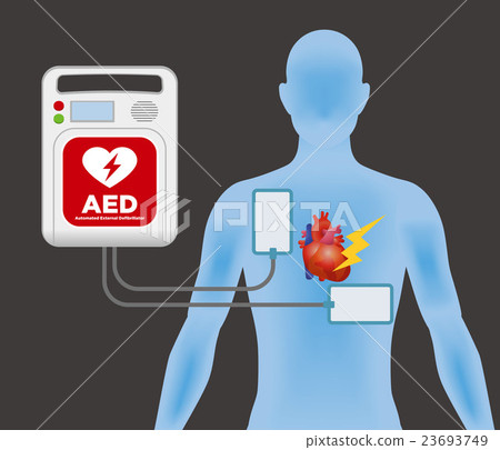 Image using AED (automatic external defibrillator) - Stock Illustration [23693749] - PIXTA