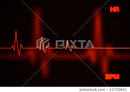 Failure Heart Rate Graph Background - Stock Illustration [23720641] - PIXTA