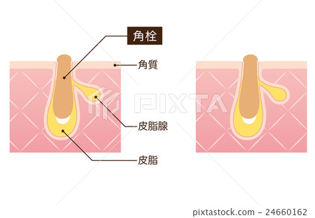 Structure of pores Rectangular plug sectional view - Stock Illustration ...