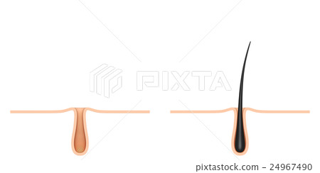 Hair root section - Stock Illustration [24967490] - PIXTA