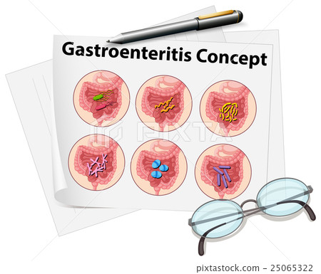 Gastroenteritis concept on paper - Stock Illustration [25065322] - PIXTA