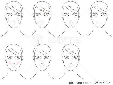 Facial skin problems acne men - Stock Illustration [25945292] - PIXTA