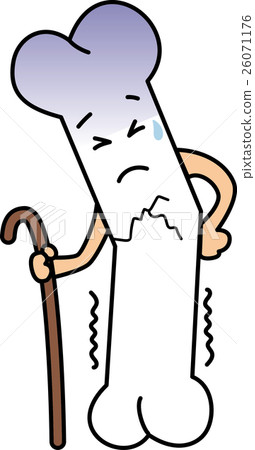 Weak bone with osteoporosis - Stock Illustration [26071176] - PIXTA