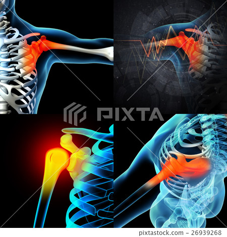 3D rendering human shoulder pain - Stock Illustration [26939268] - PIXTA