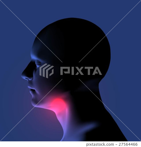 Laryngitis vector illustration. Human throat - Stock Illustration ...