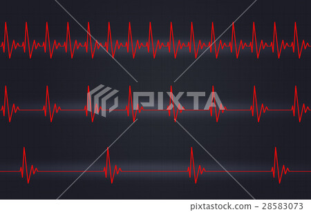 Fast Normal Slow Heartbeat Illustration - Stock Illustration [28583073 ...