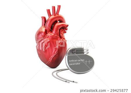 Artificial cardiac pacemaker, 3D rendering - Stock Illustration ...
