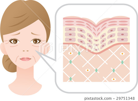 Wrinkle skin cross section - Stock Illustration [29751348] - PIXTA