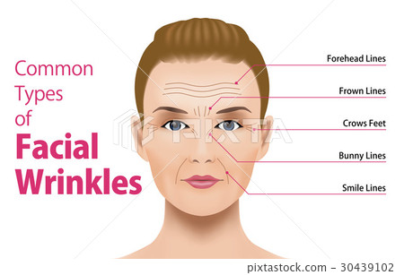 Types of facial wrinkles - Stock Illustration [30439102] - PIXTA
