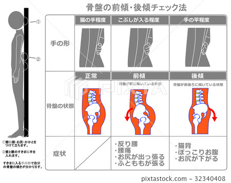 Front anteversion / posterior inclination check... - Stock Illustration ...