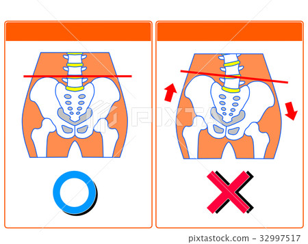 Comparison of pelvic distortion (normal,... - Stock Illustration ...