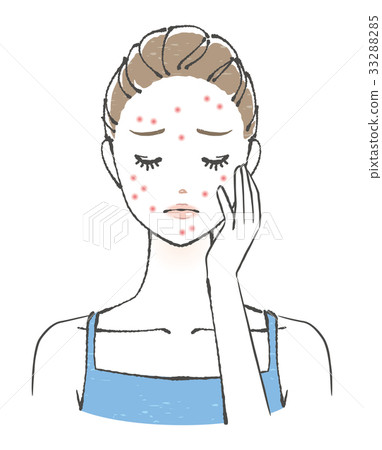 Acne illustration - Stock Illustration [33288285] - PIXTA
