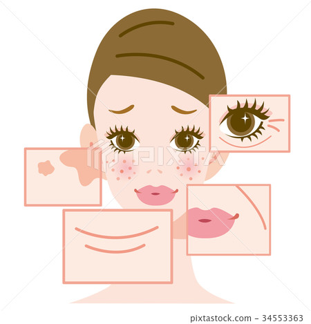 Skin damage - Stock Illustration [34553363] - PIXTA