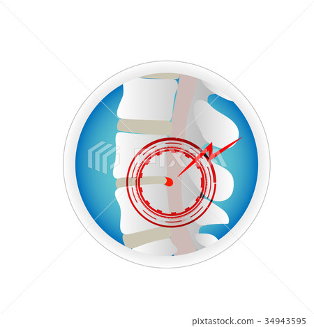 herniated disc - Stock Illustration [34943595] - PIXTA