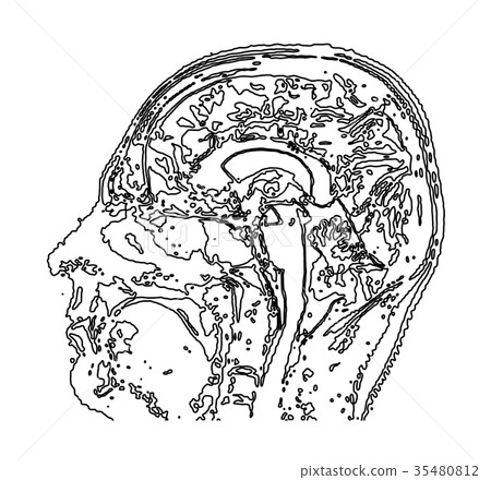 Topographic map MRI of the human brain. - Stock Illustration [35480812 ...