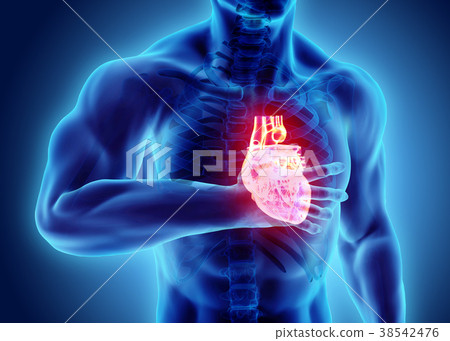 3d illustration of human heart attack. - Stock Illustration [38542476 ...