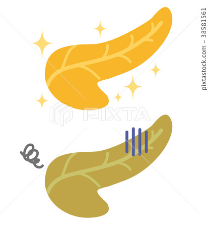 Healthy Pancreas Weak Pancreas - Stock Illustration [38581561] - PIXTA