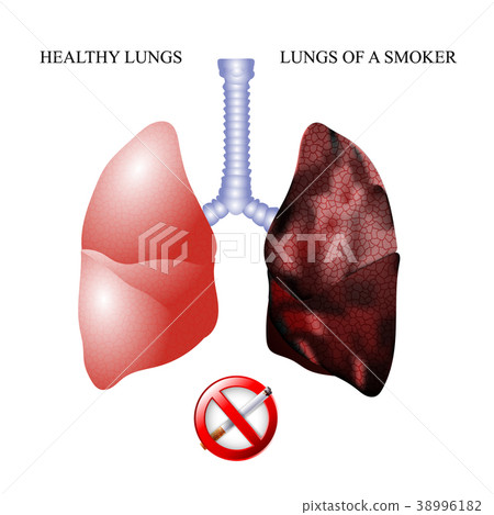 the lungs of a healthy person and smoker alveoli - Stock Illustration ...
