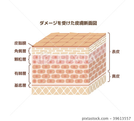 Cross section illustration of damaged human... - Stock Illustration ...