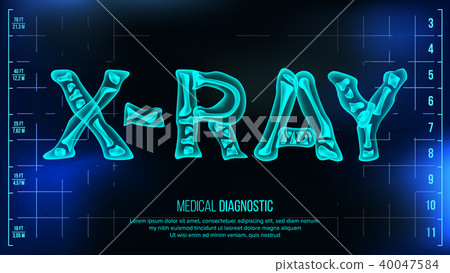 X-ray Banner Vector. Medical Background.... - Stock Illustration ...