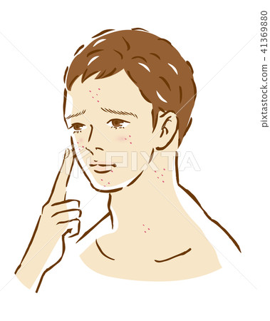 Male acne skin trouble beauty Beauty - Stock Illustration [41369880 ...
