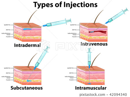 A Set of Type of Injections - Stock Illustration [42094340] - PIXTA