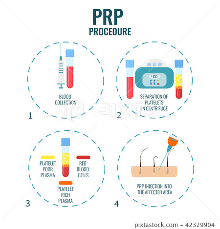 PRP treatment poster - 스톡일러스트 [42329904] - PIXTA